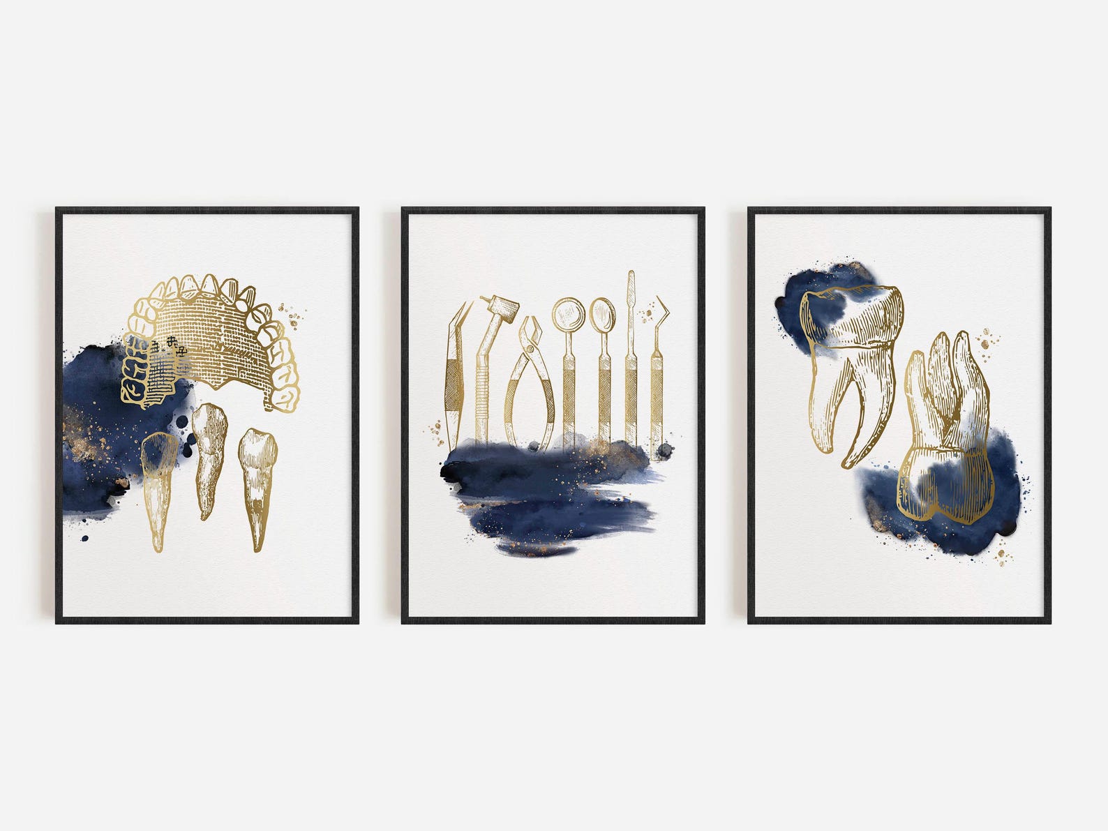 Dental Office Art Prints: Gold & Navy Tooth Decor (digital Download) - Etsy