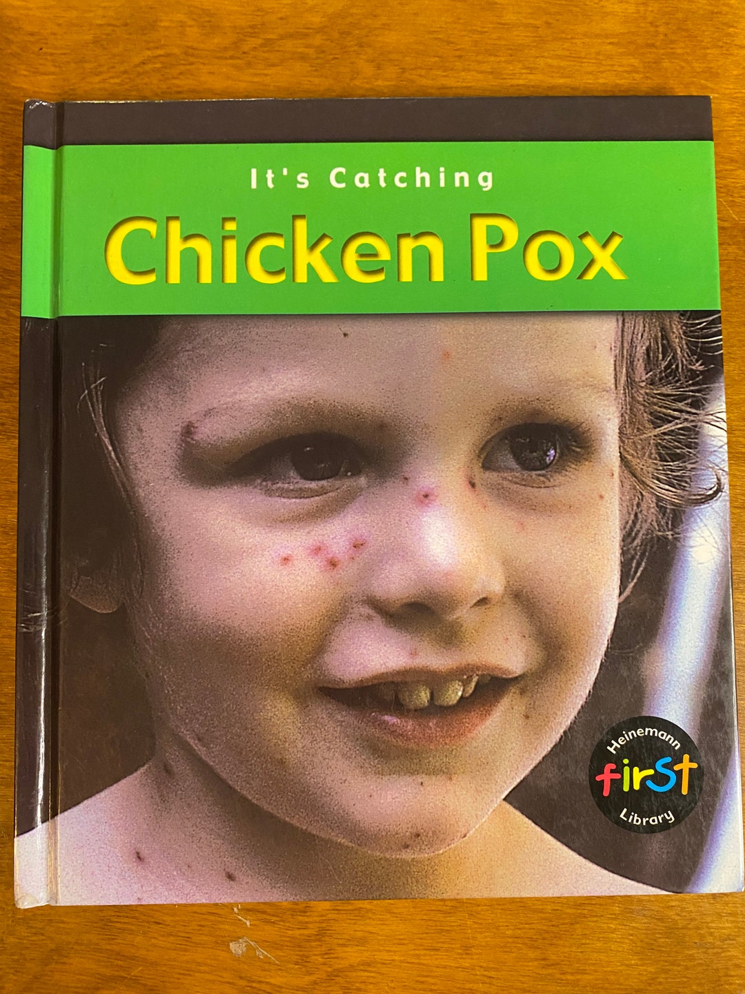 Its Catching: Chicken Pox by Angela Royston00s Picture Book - Etsy