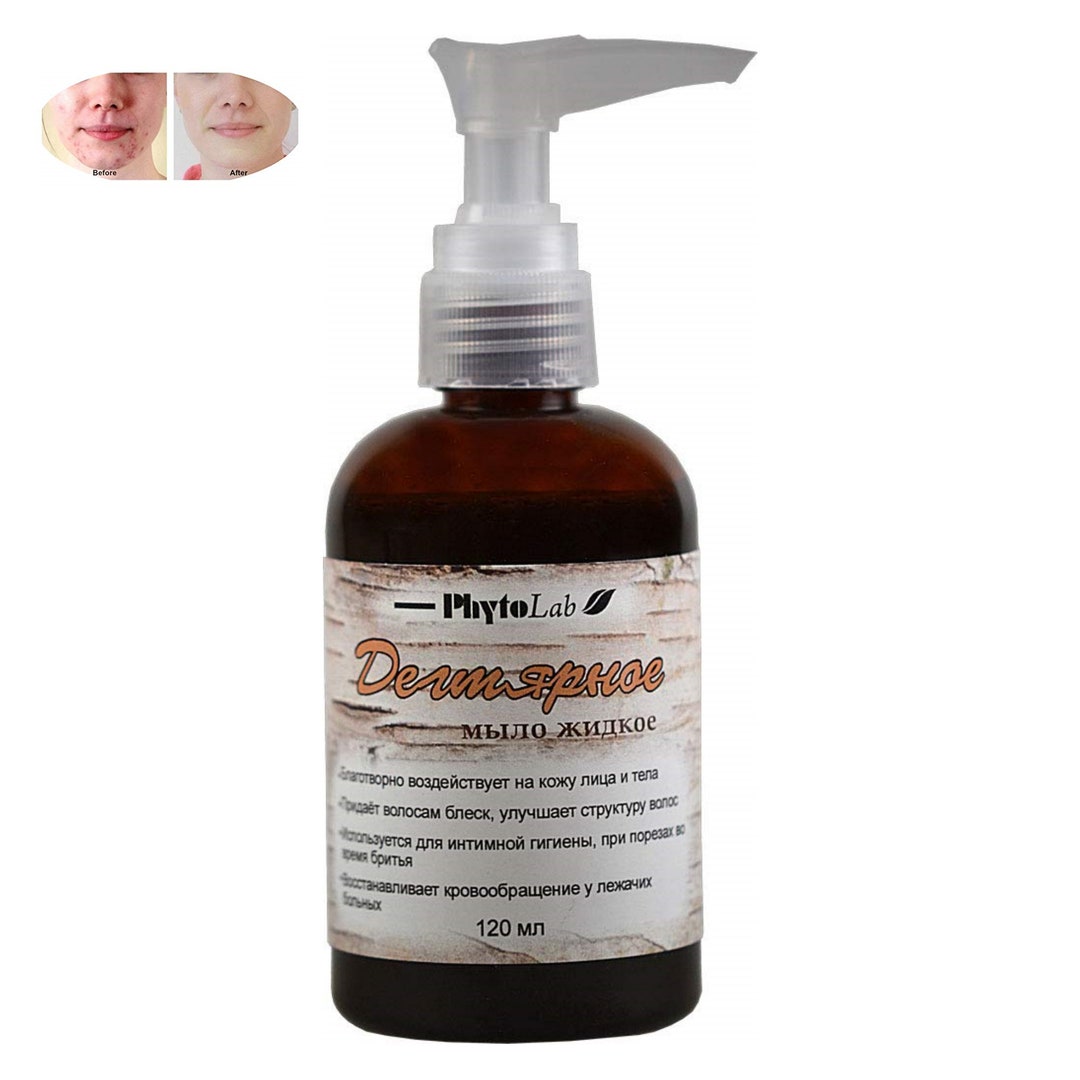 Birch Tar Liquid Soap - Natural Antiseptic to Treat Skin Conditions ...