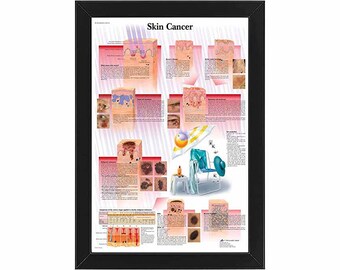 Human Skin Poster - Etsy UK