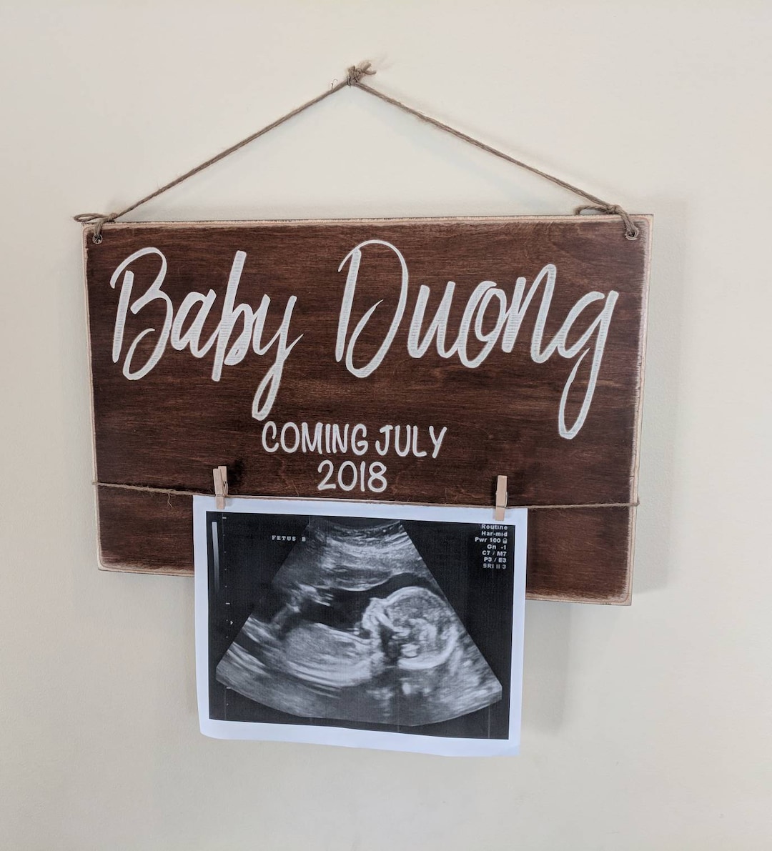 Birth Announcement Sign Personalized Baby Announcement Sign Baby Coming ...