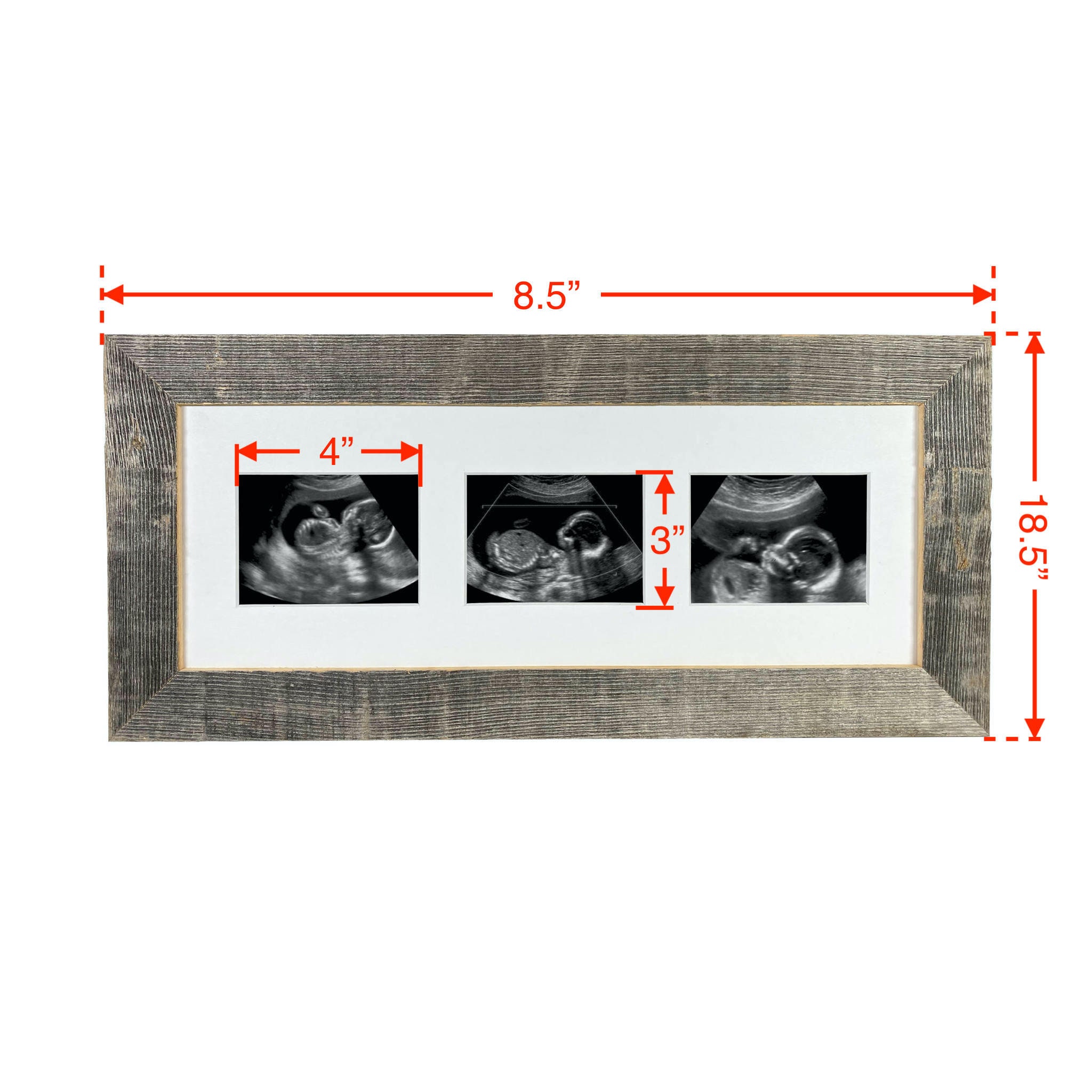 Sonogram Picture Frame |baby Ultrasound Trimester Progression Keepsake ...