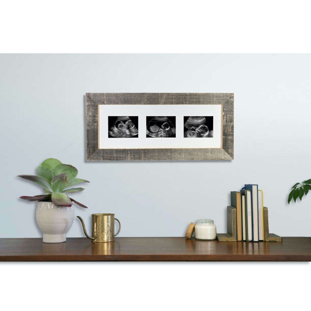 Sonogram Picture Frame |baby Ultrasound Trimester Progression Keepsake ...