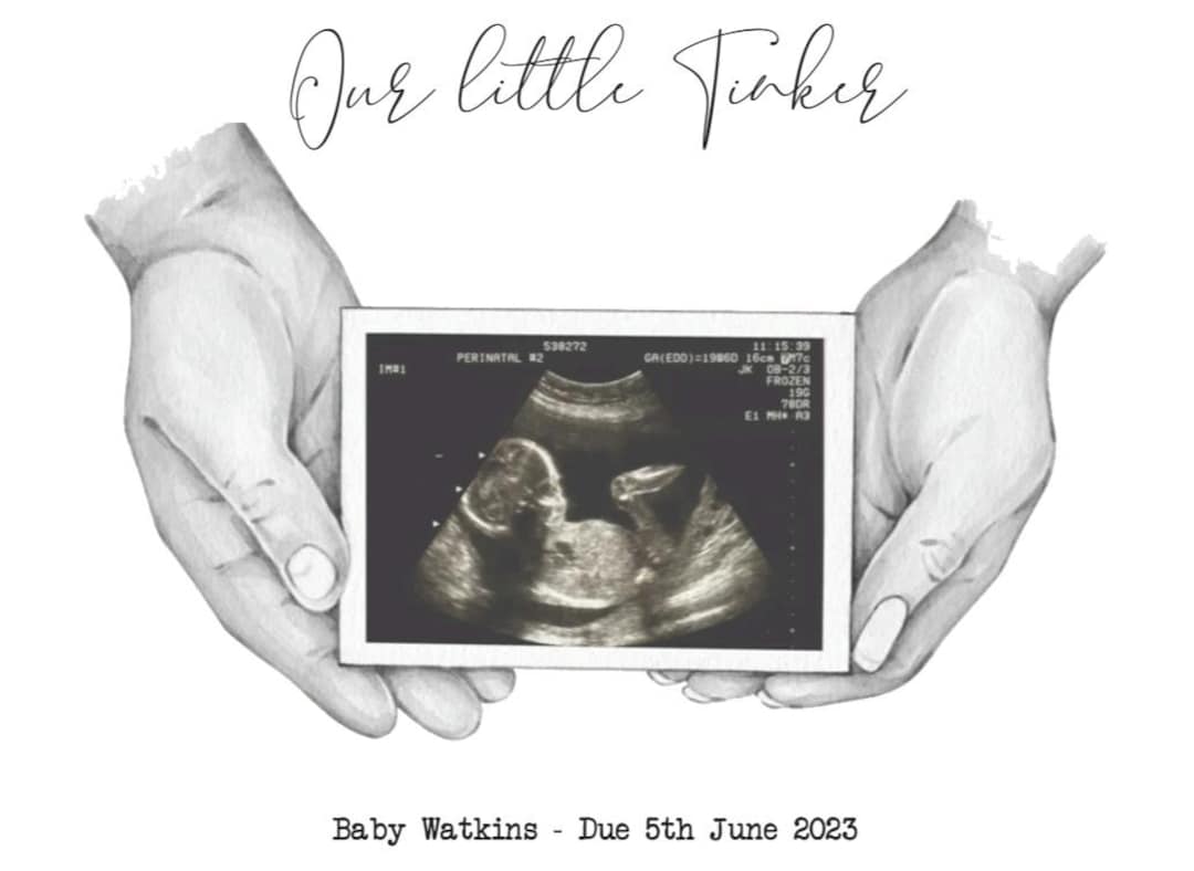 Baby Scan Picture, Love at First Heart Beat, Pregnancy Announcement ...