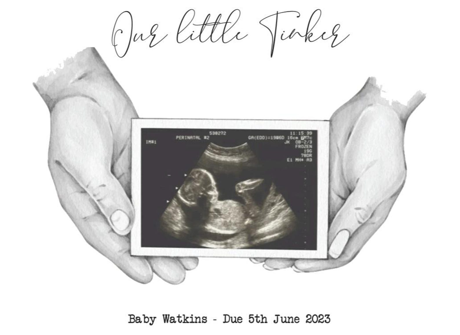 Baby Scan Picture, Love at First Heart Beat, Pregnancy Announcement ...