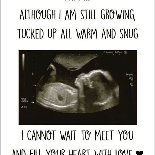 Baby Scan Picture, Love at First Heart Beat, Pregnancy Announcement ...