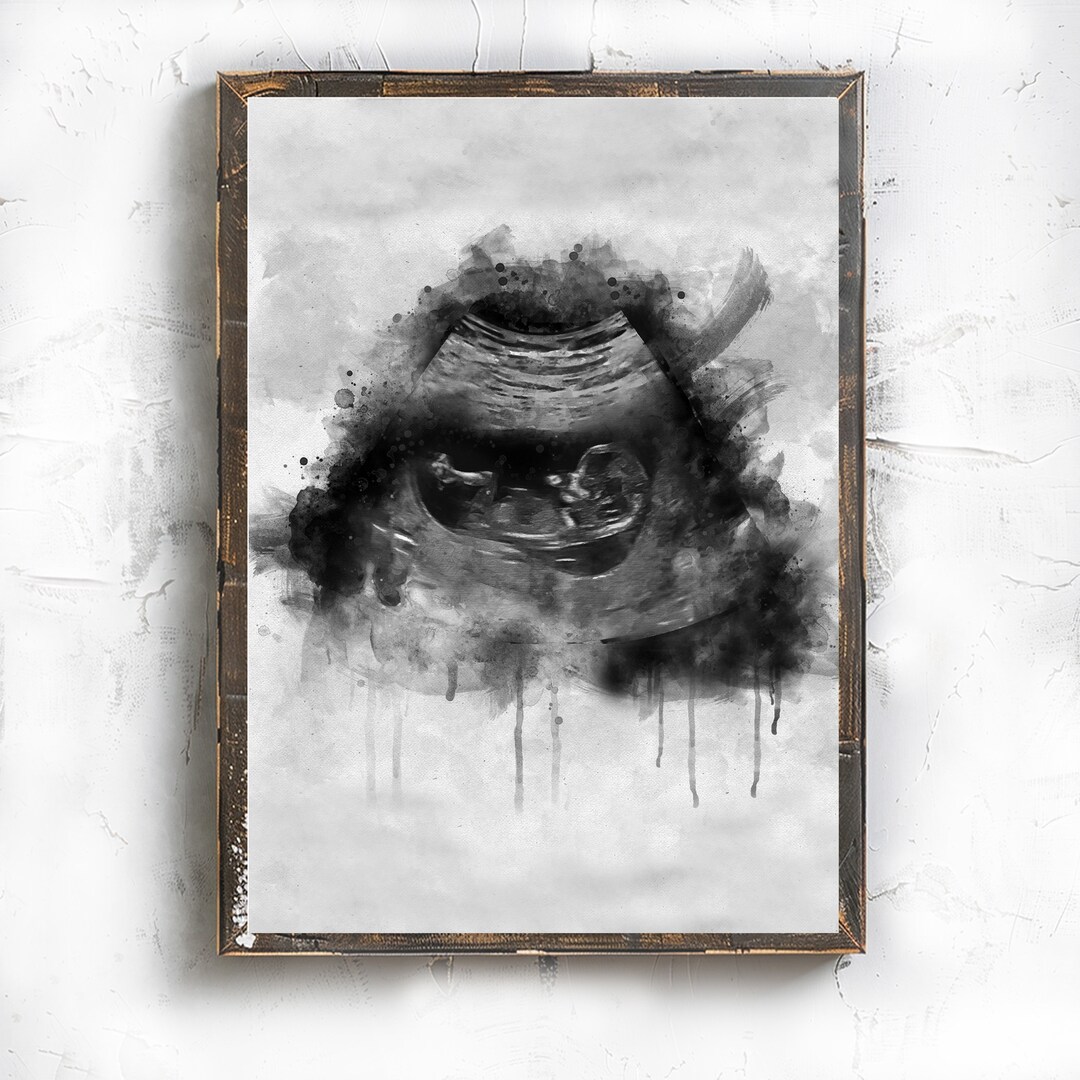 Personalized Baby Ultrasound Custom Painting From Photo Watercolor ...