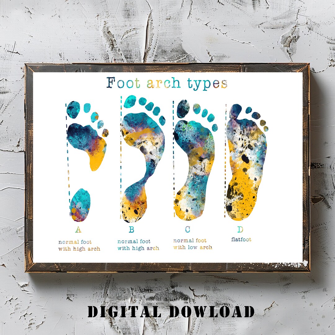 Types of Footprints Printable Wall Art Foot Arch Types Watercolor Print ...