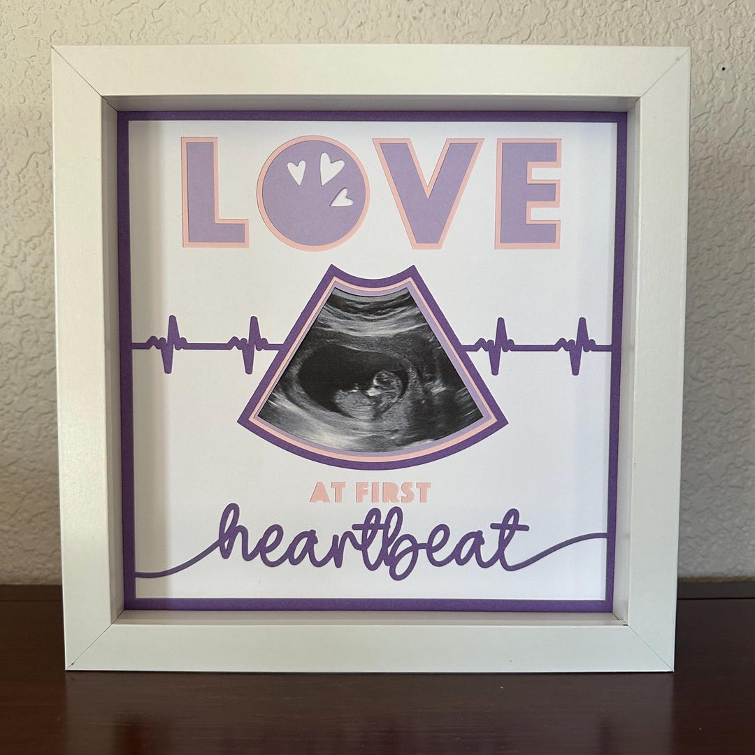 Baby Sonogram Shadow Box Frame – Pregnancy Keepsake Gift - Etsy