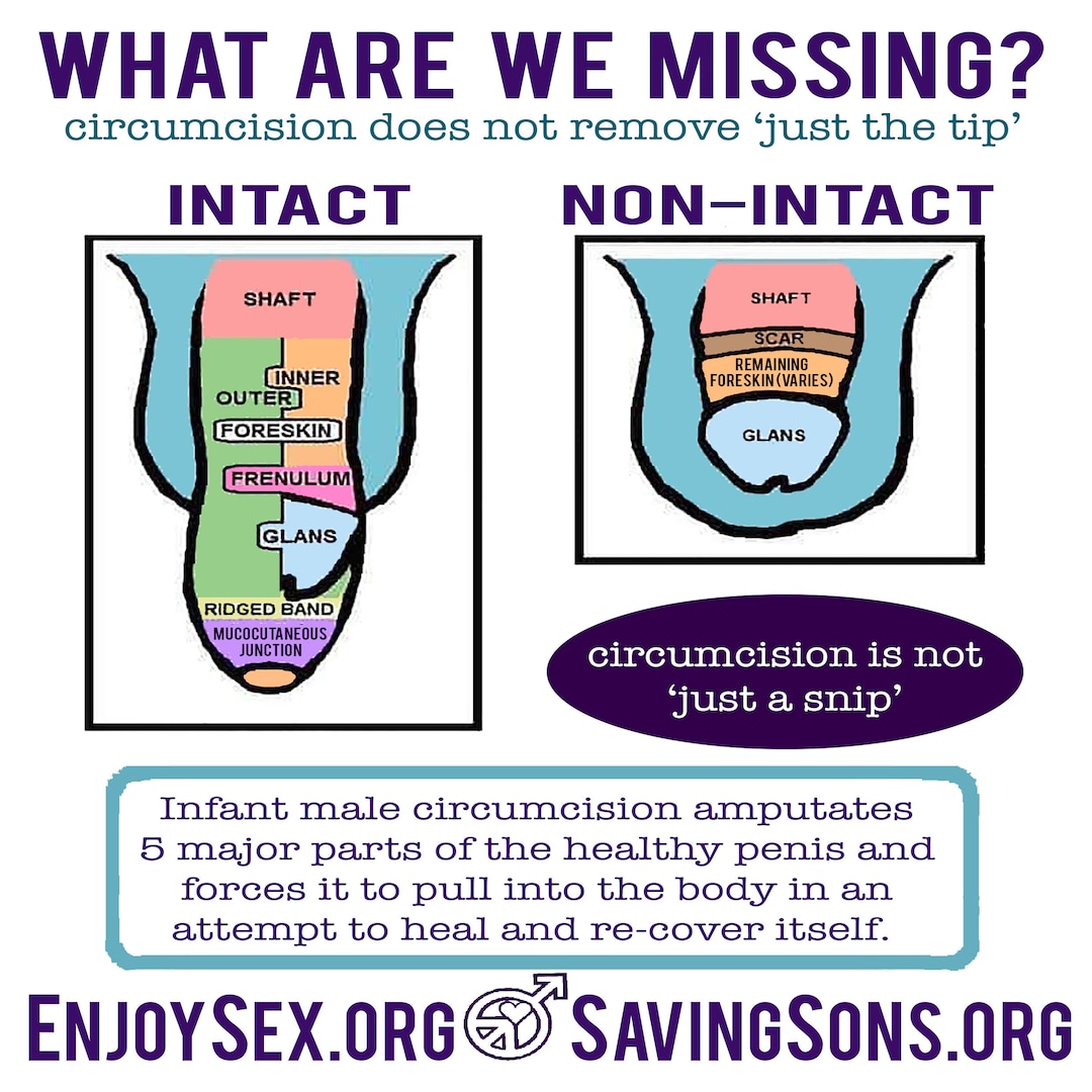 Buy What Are We Missing? Intactivist Foreskin Vinyl Stickers Online in ...