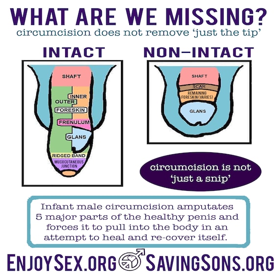 What Are We Missing Intactivist Foreskin Vinyl Stickers - Etsy India