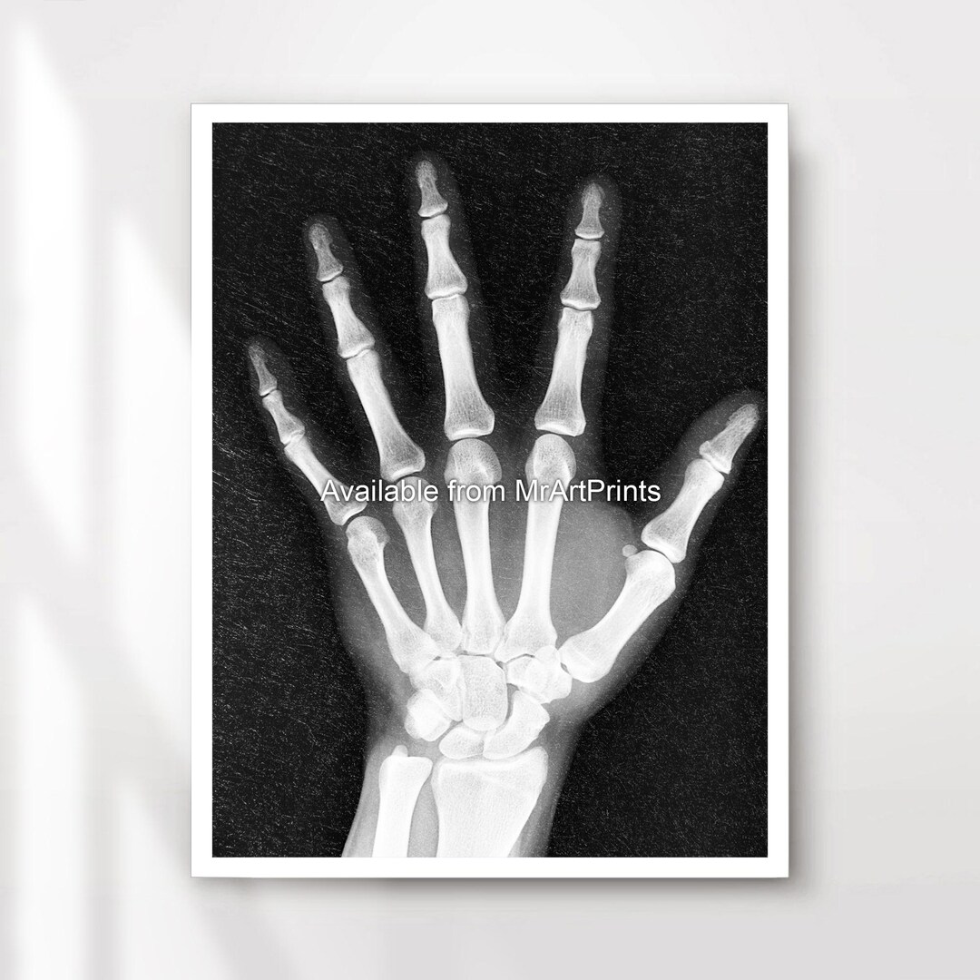 X-ray Hand Bones Skeleton Medical Diagram Art Print Poster Wall Picture ...