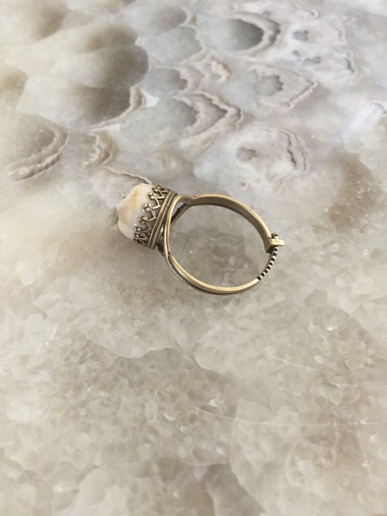Human Tooth and Faux Diamond Cavity Ring | Etsy