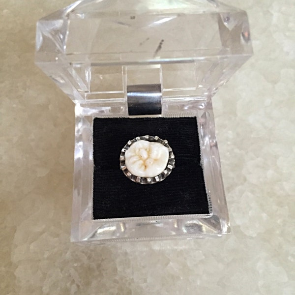 Human Tooth Ring - Etsy