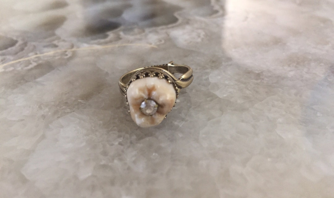 Human Tooth and Faux Diamond Cavity Ring - Etsy