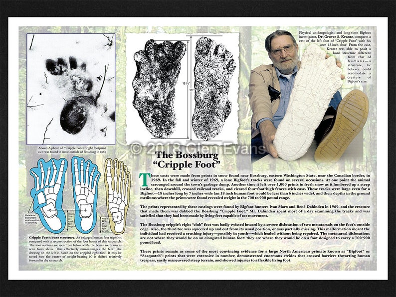Cripple Foot Bigfoot/sasquatch Footprint Cast Poster (bossburg ...