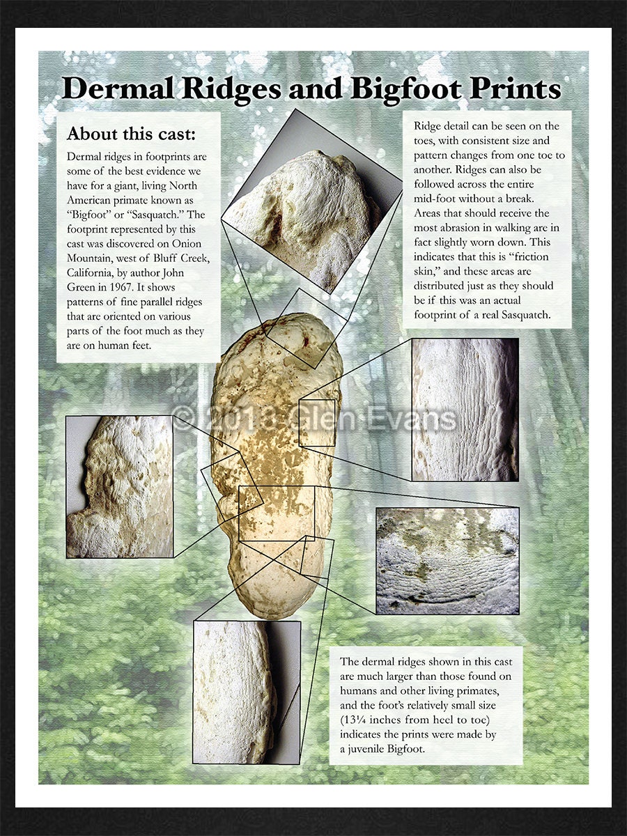 Epidermal Ridges Model