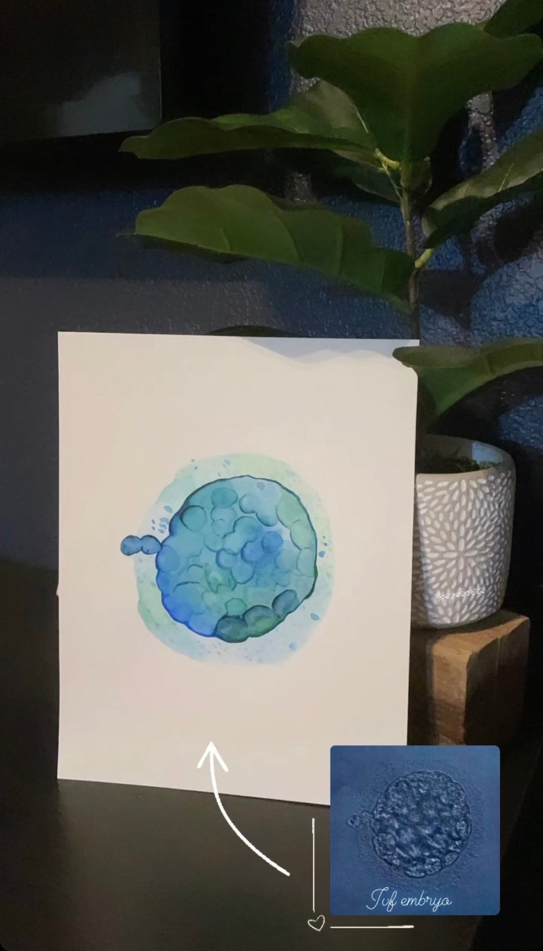 IVF Embryo Custom Watercolor Painting - Etsy