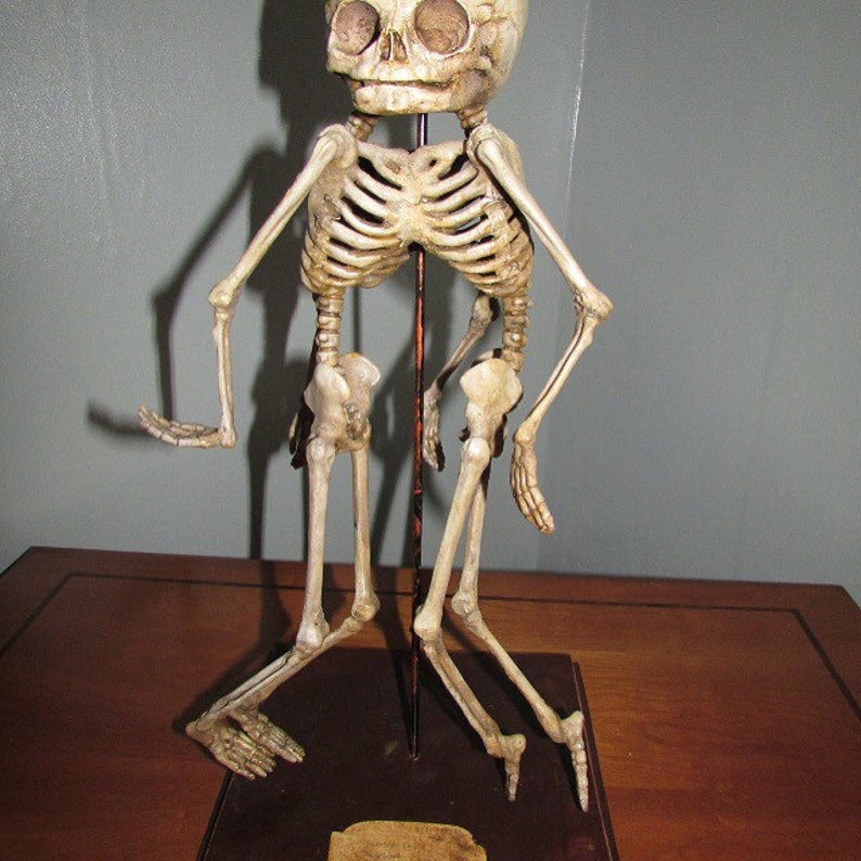 Conjoined twins handmade. Free shipping replica skeletons | Etsy