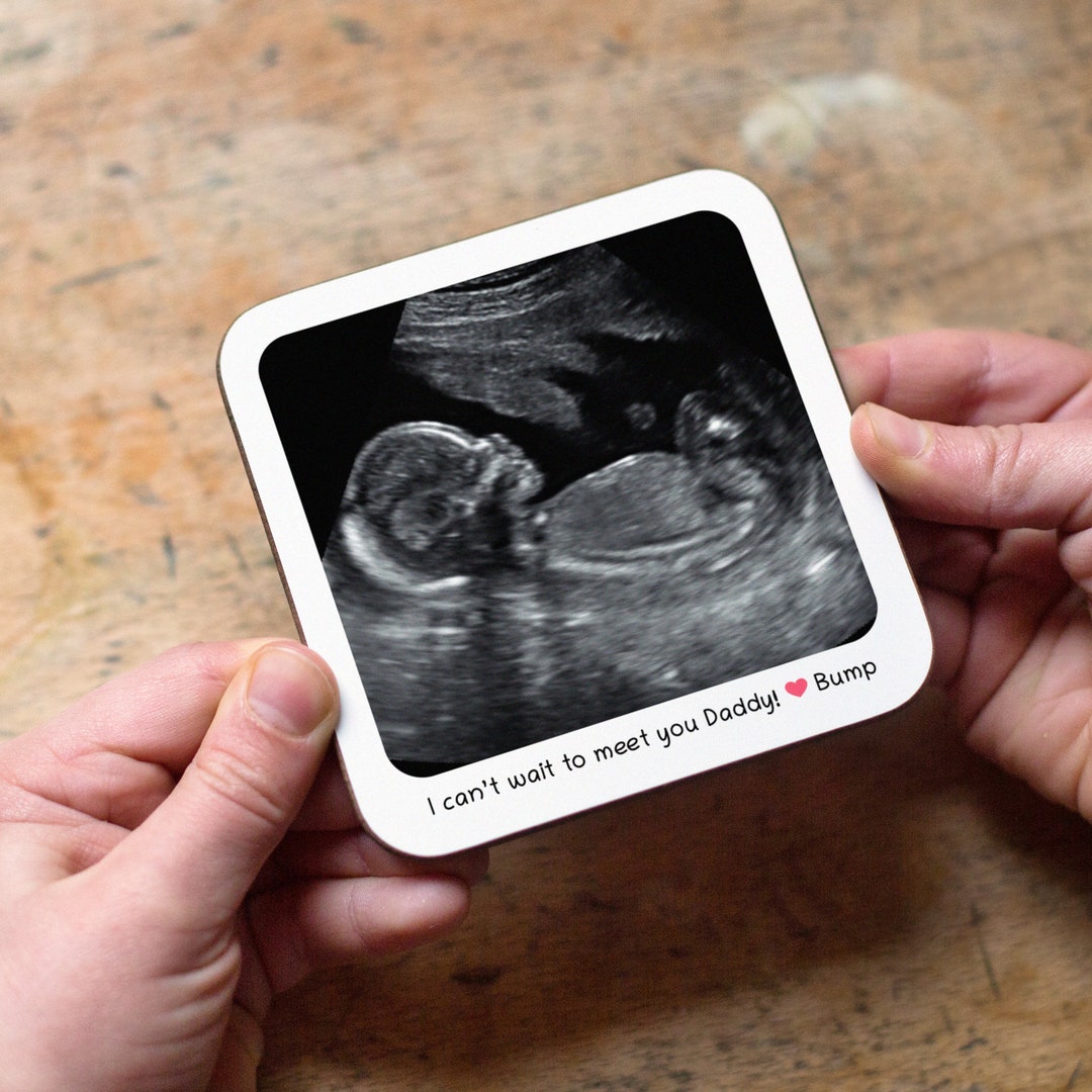 Personalised Baby Scan Coaster, Custom Baby Ultrasound Gift, Baby ...