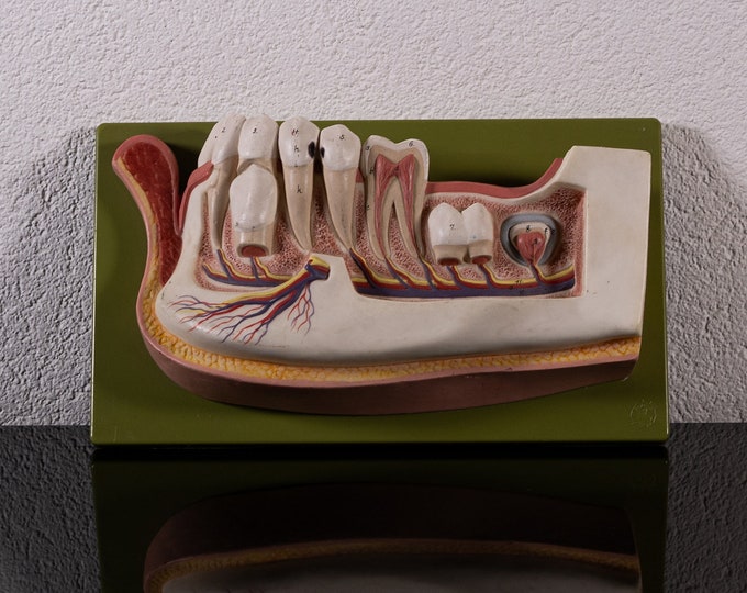 Vintage Model of the Lower Jaw ,these Anatomy Models, Used for ...