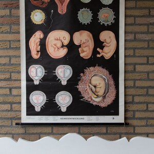 Vintage Pull Down Chart Development of the Human Embryo School Chart - Etsy