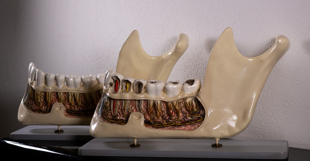 Vintage 2 Models of the Lower Jaw XXL With an Original Case, These ...