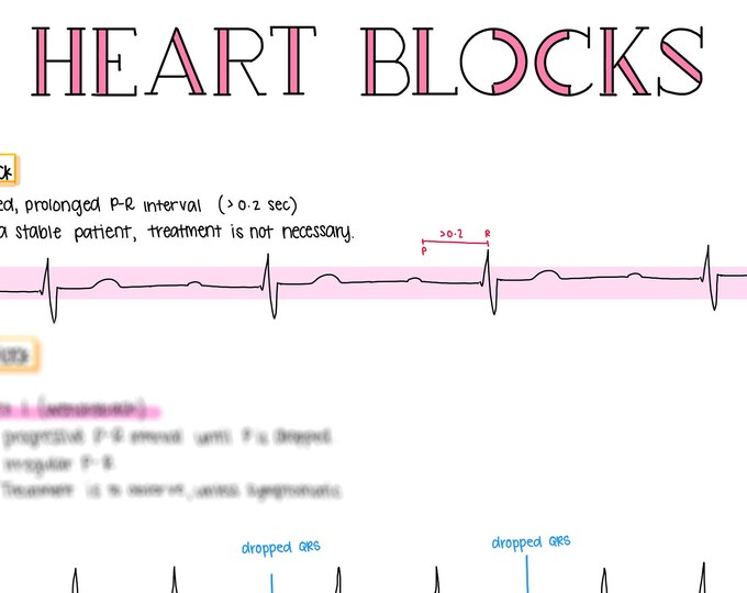 Heart Blocks Study Sheet - Etsy