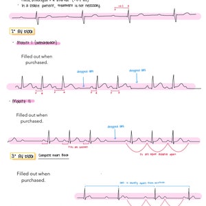 Heart Blocks Study Sheet - Etsy UK