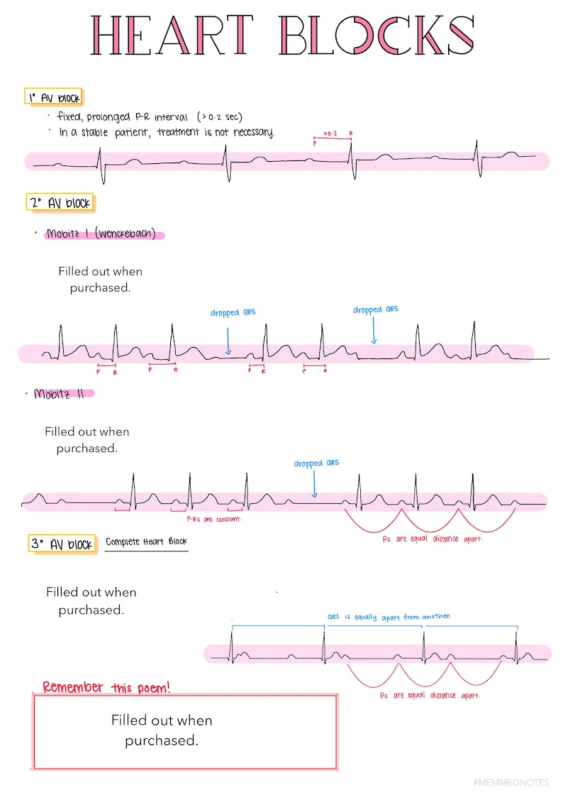 Heart Blocks Study Sheet - Etsy