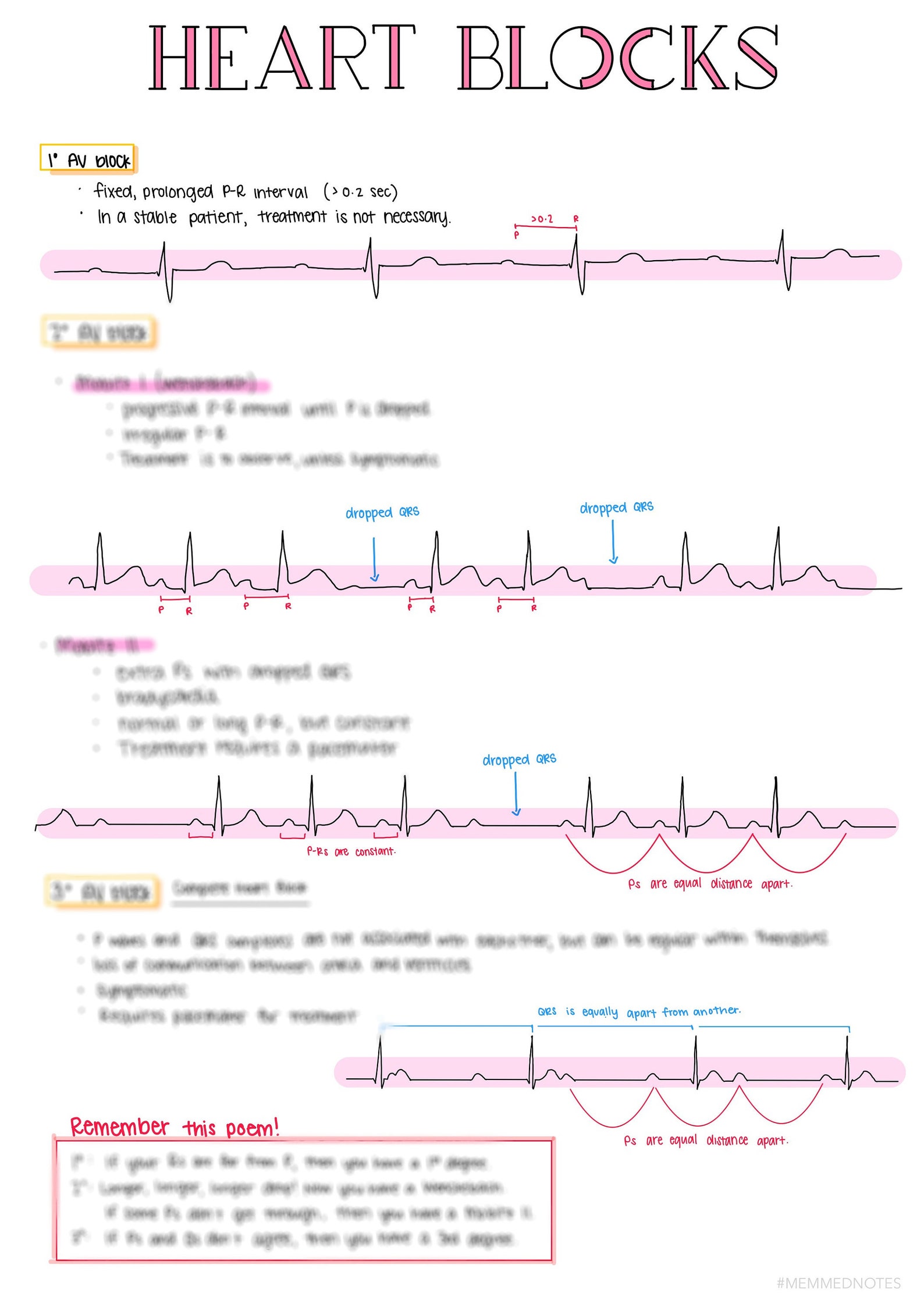 Heart Blocks Study Sheet - Etsy UK