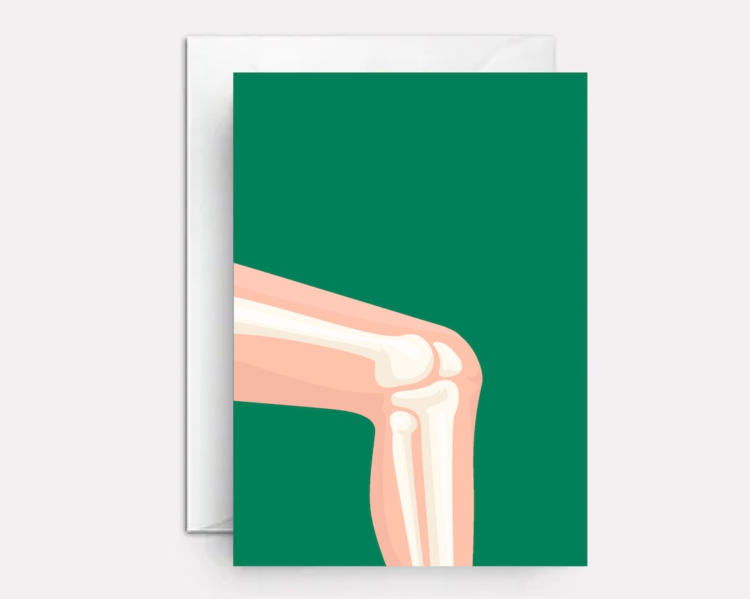 Knee Surgery Get Well Card | Knee Operation Card | Knee Surgery Card ...