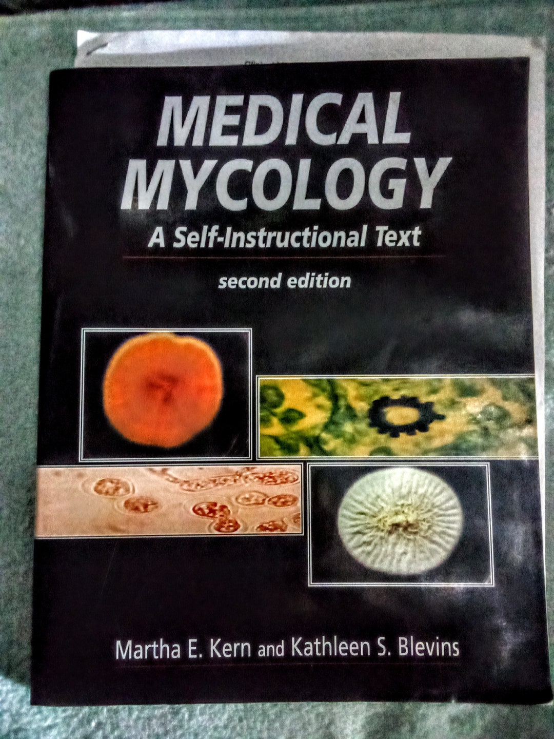 Medical Mycology (old Medical Textbook), 2nd Edition. Year Unknown. - Etsy