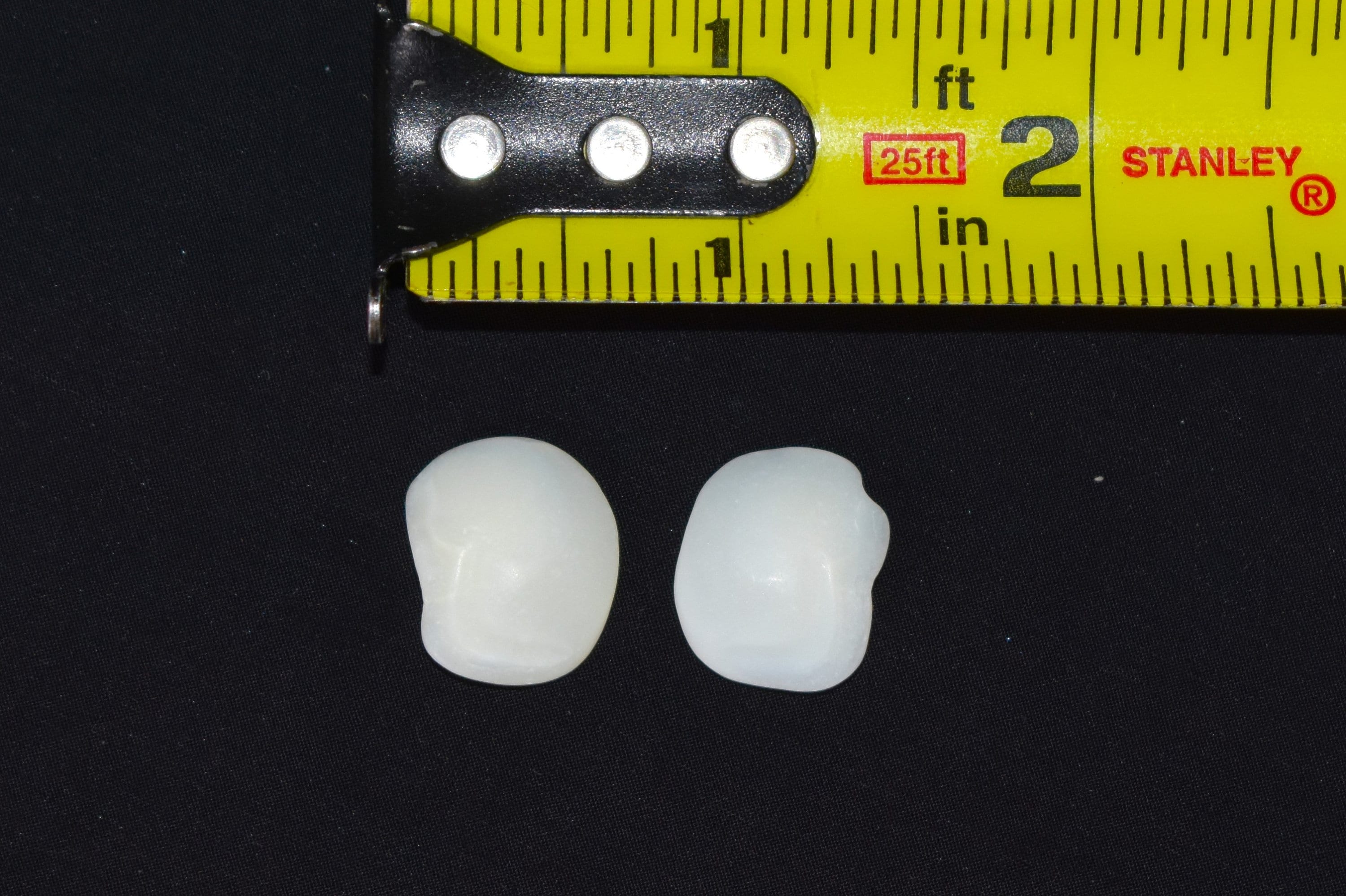 Lucky Stones Matching Set,otolith,sheephead Stone,fish Ear,freshwater ...