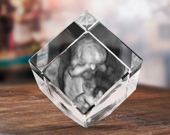 3d Sonogram Art - Etsy