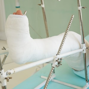 Vintage Leg Orthopedic Medical Traction Device With Pulleys / Medfet ...