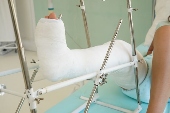 Broken Leg Traction