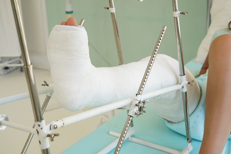 Vintage Leg Orthopedic Medical Traction Device With Pulleys / - Etsy