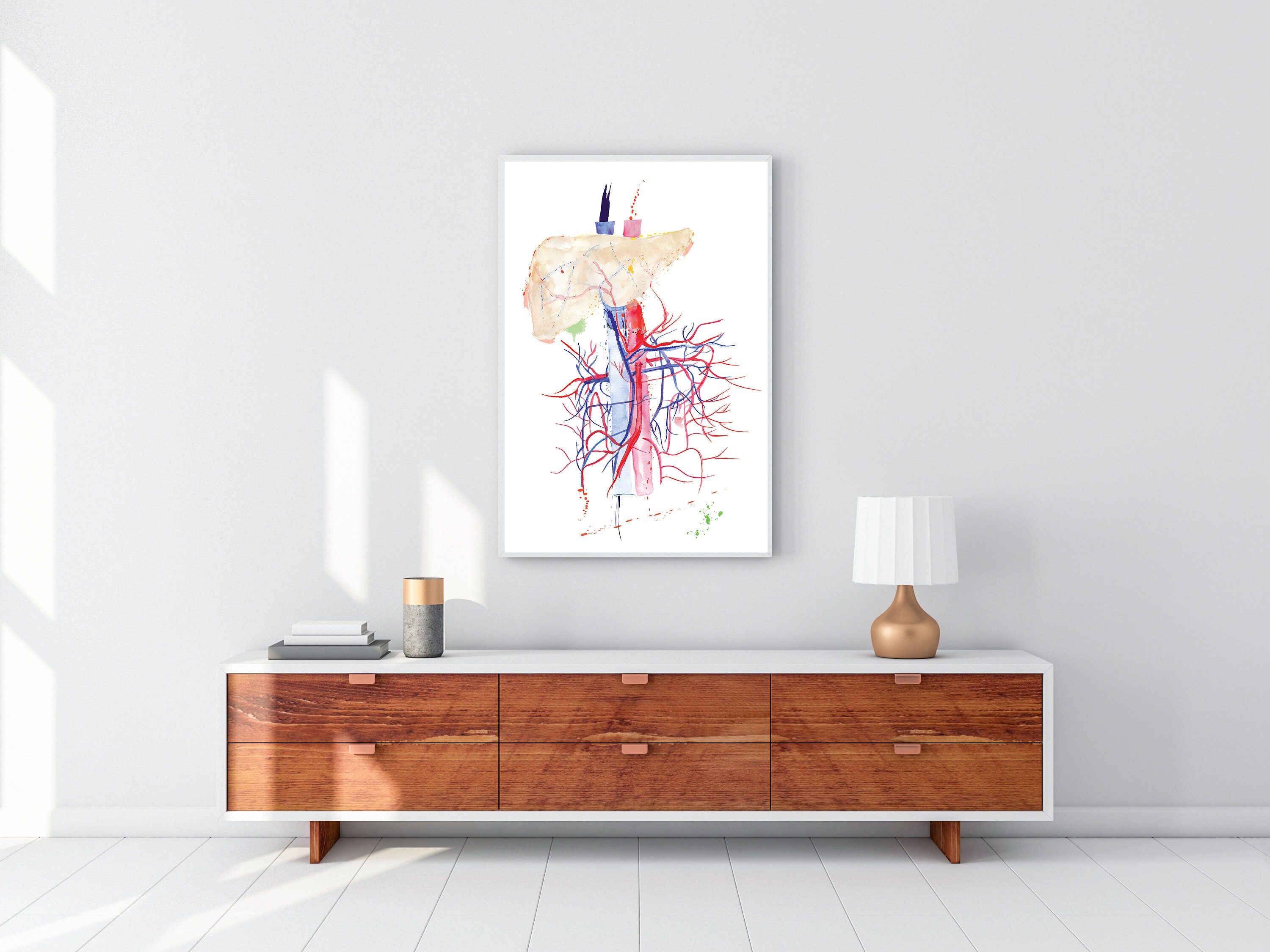 General Surgery Art Vascular Surgery Art Abdominal Arteries - Etsy