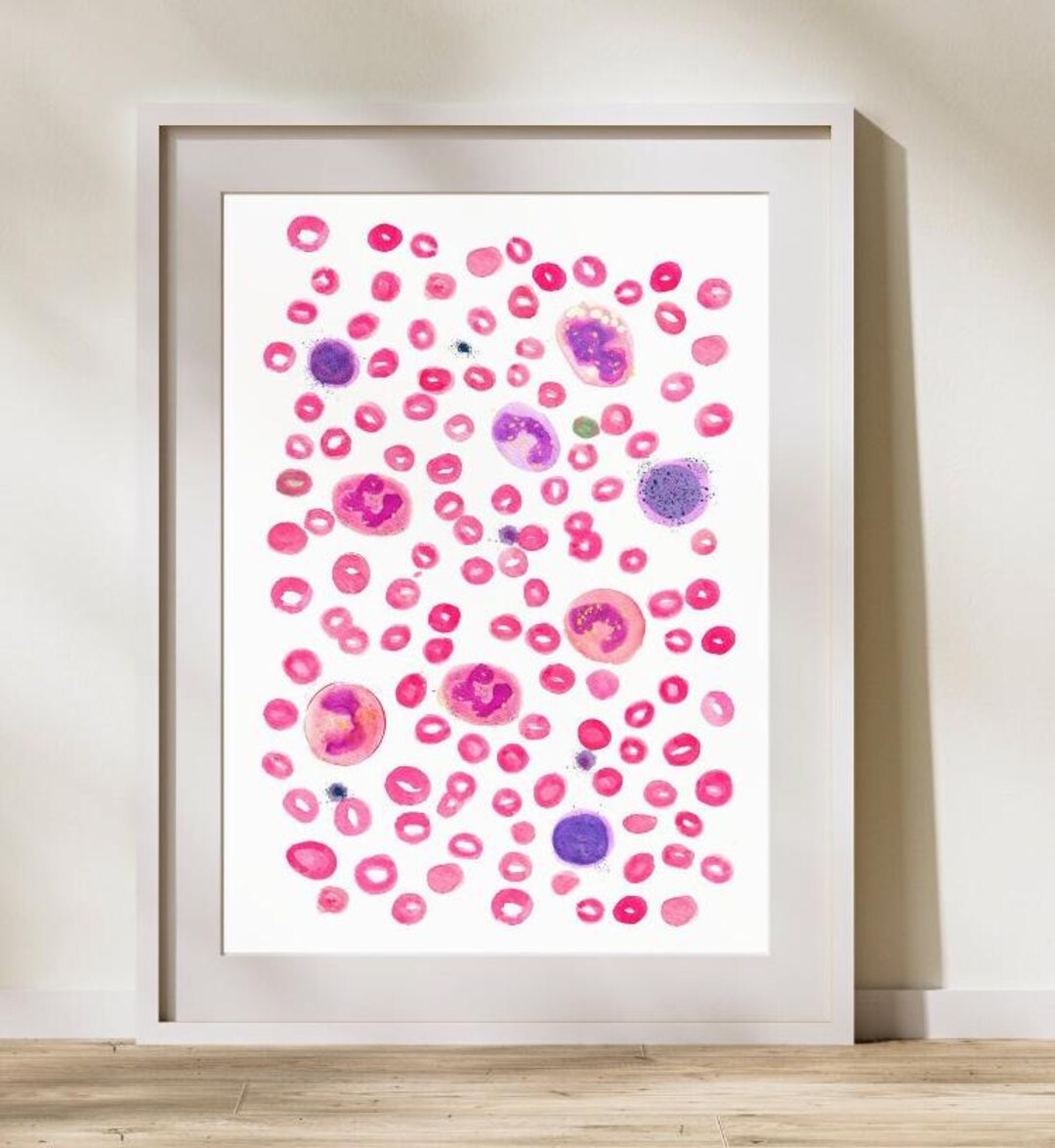 Blood Smear Watercolor Art Print for Hematology and Phlebotomy Office ...