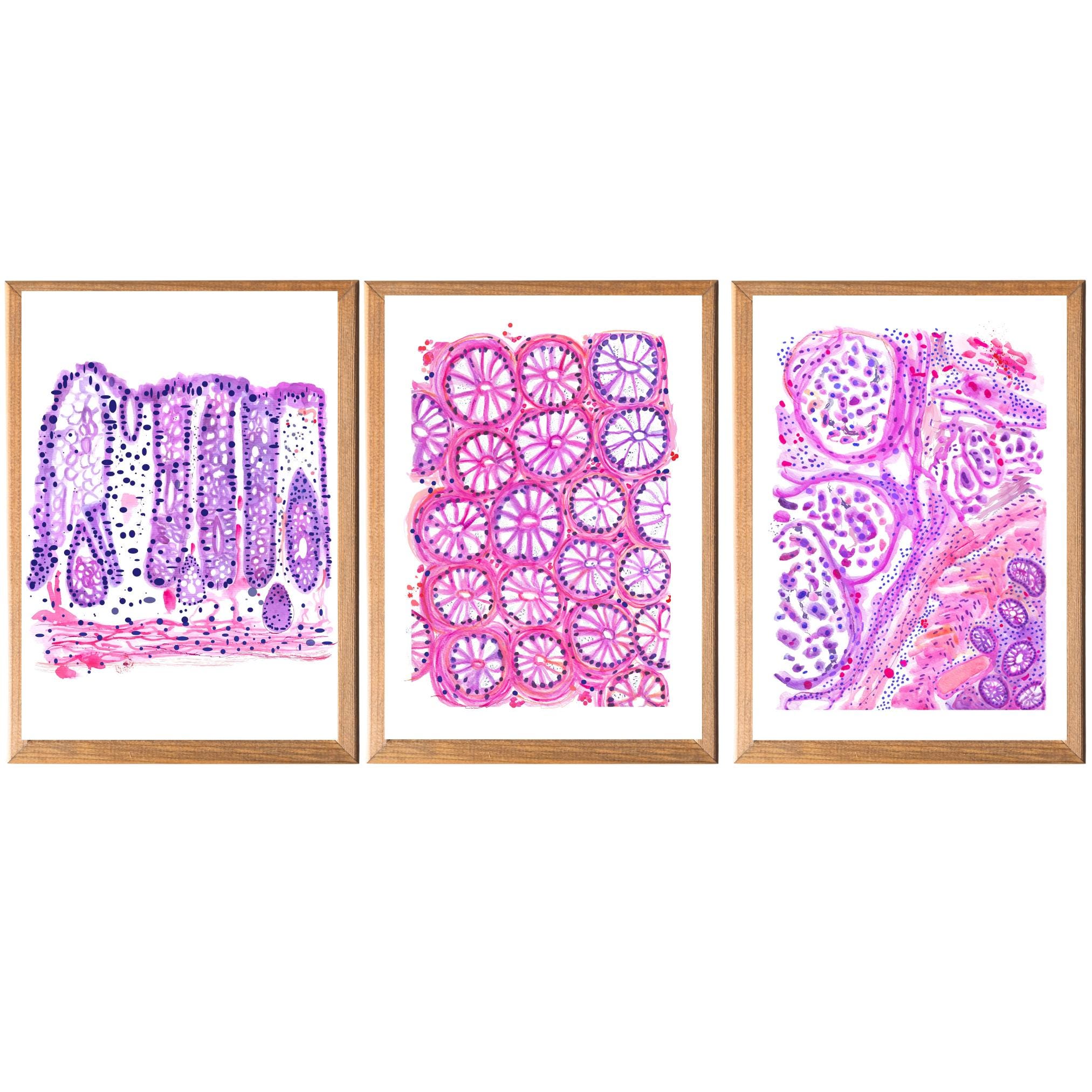Colon Histology and Pathology Watercolor Art, Gastroenterology and ...