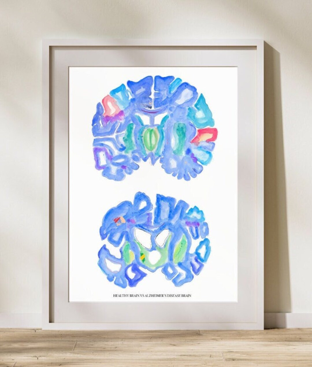 Alzheimer's Awareness, Neurology Art, Neurology Gifts, Neurologist ...
