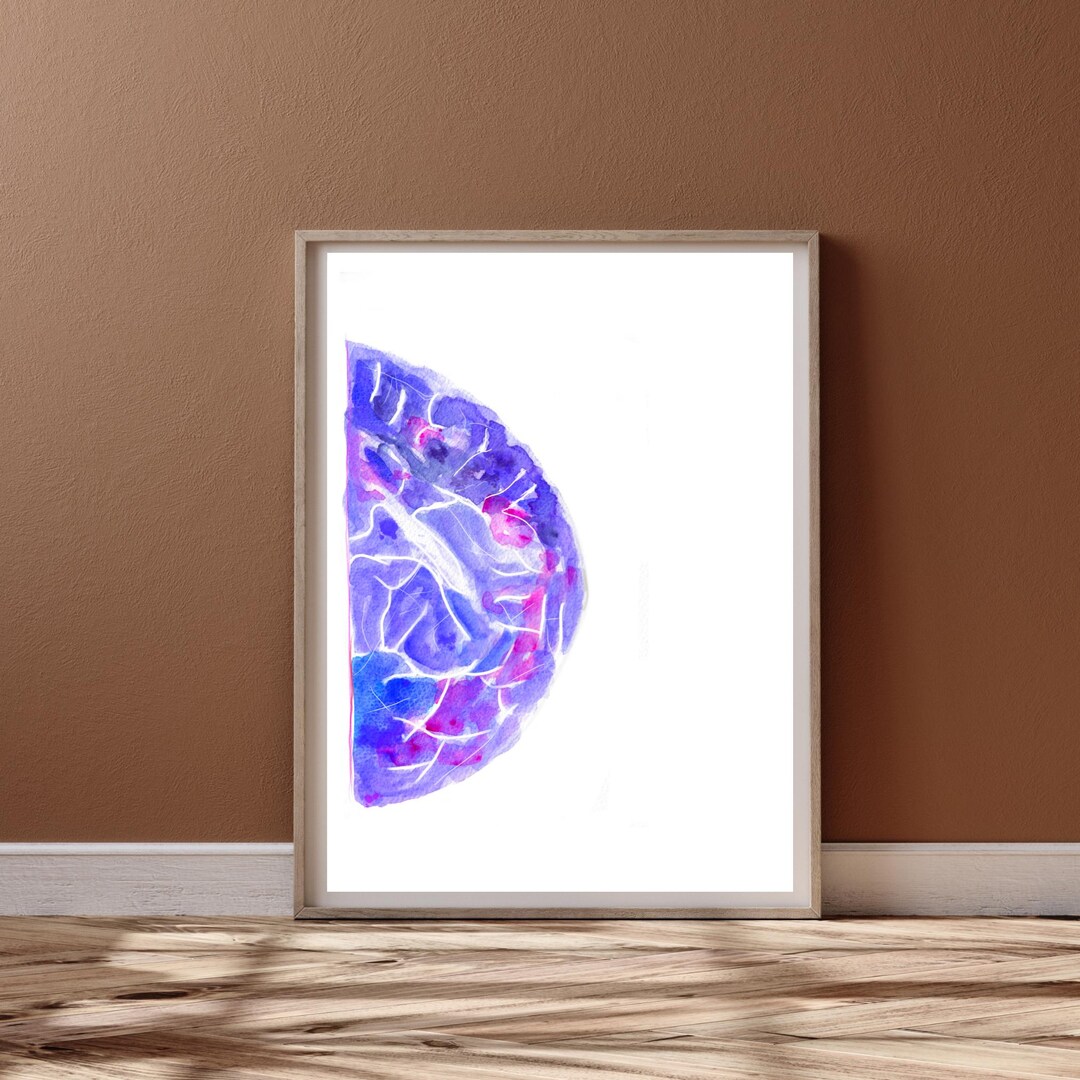Mammogram - Mammography Art, Radiology Art, Breast Care Nurse Gift ...