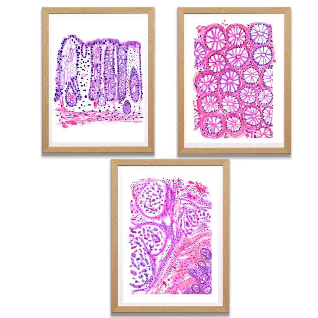 Colon Histology and Pathology Watercolor Art Print, Pathology Wall Art ...