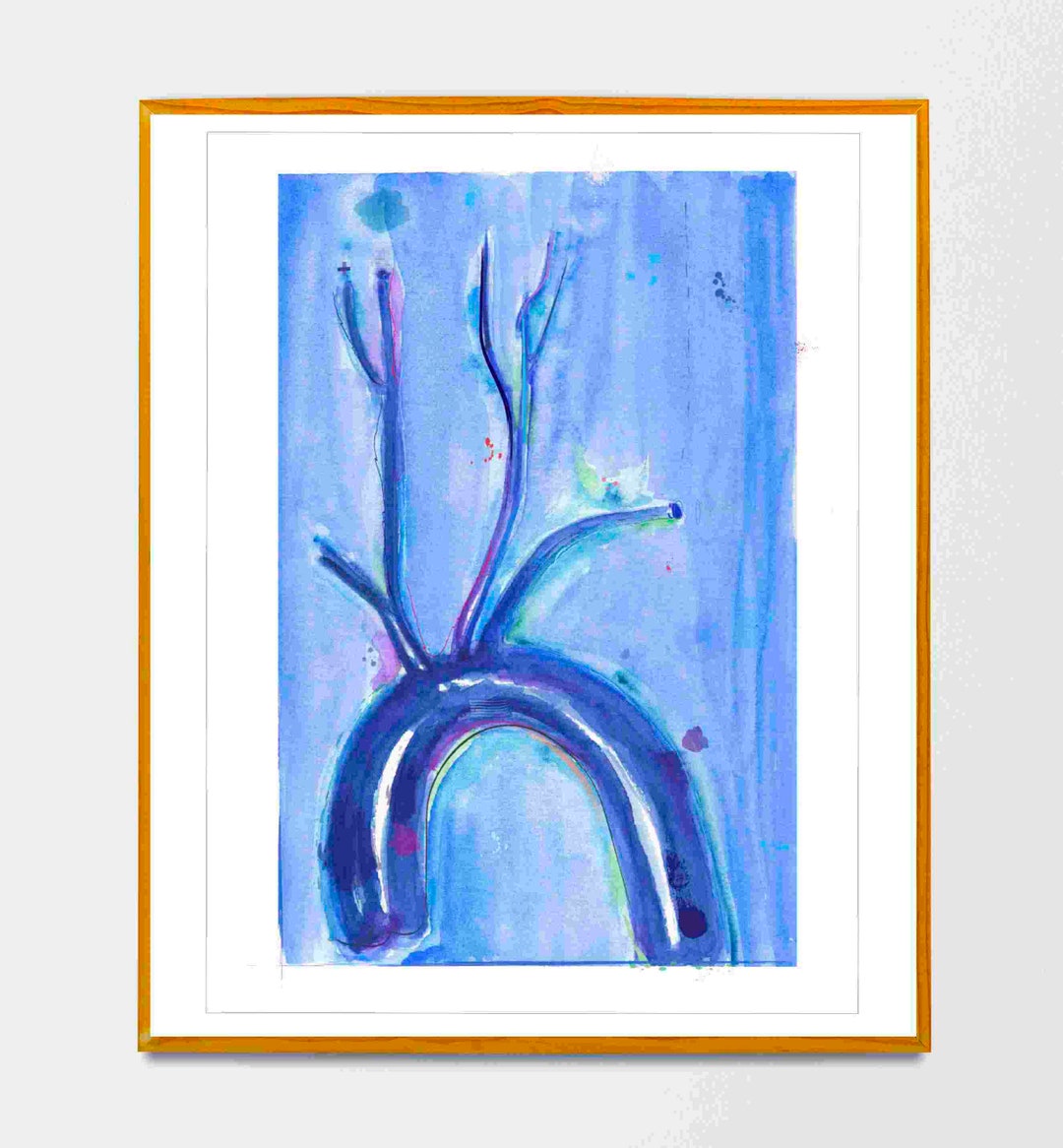 Aorta Art Anatomy Art Poster Cardiology Decor Cardiology - Etsy