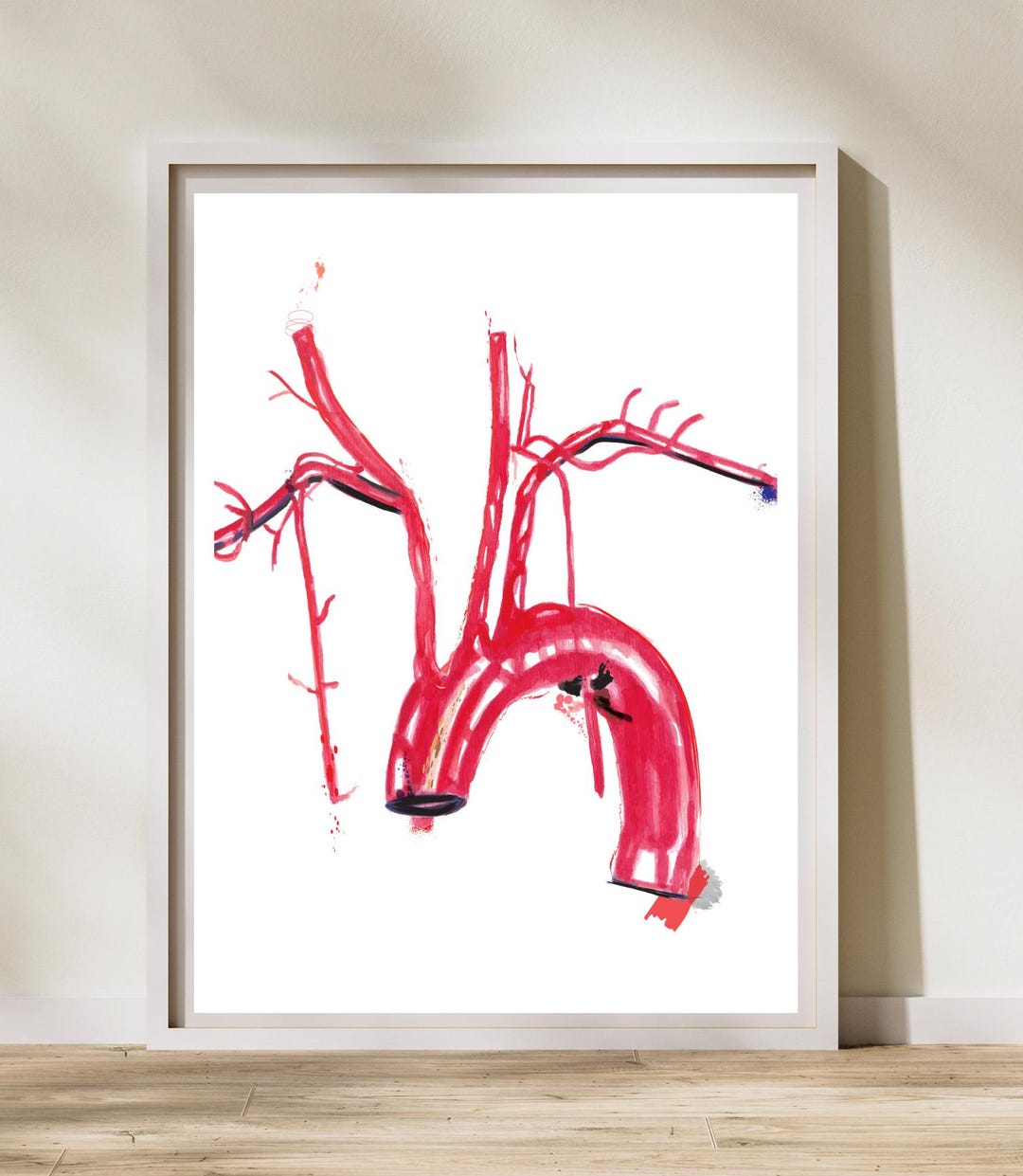 Aorta Anatomy, Aorta Art, Cardiology Art, Human Anatomy Art ...