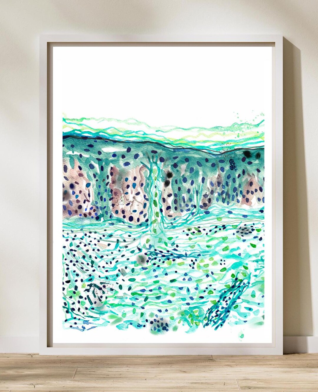Melanoma Abstract Histopathology Art, Histology Pathology Art ...
