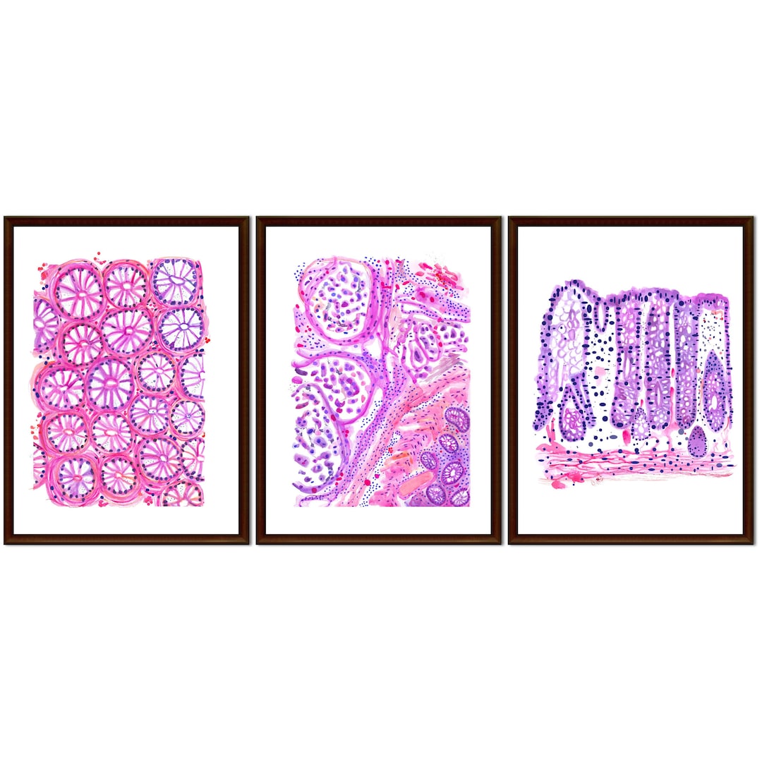 Colon Histology and Pathology Watercolor Art Print, Pathology Wall Art ...