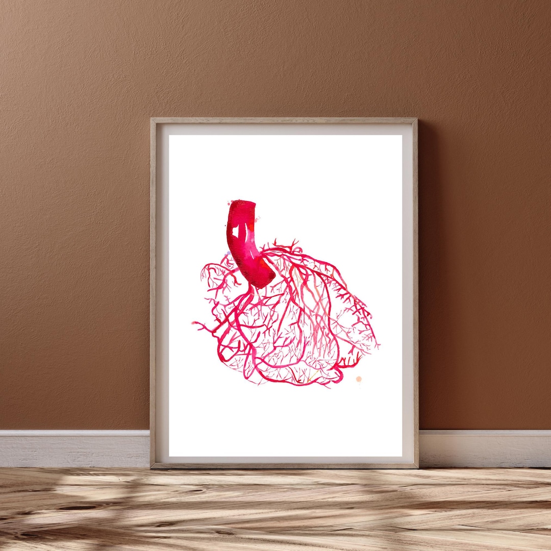 Coronary Angiogram - Cardiology Art - Heart Anatomy Art - Cardiologist ...