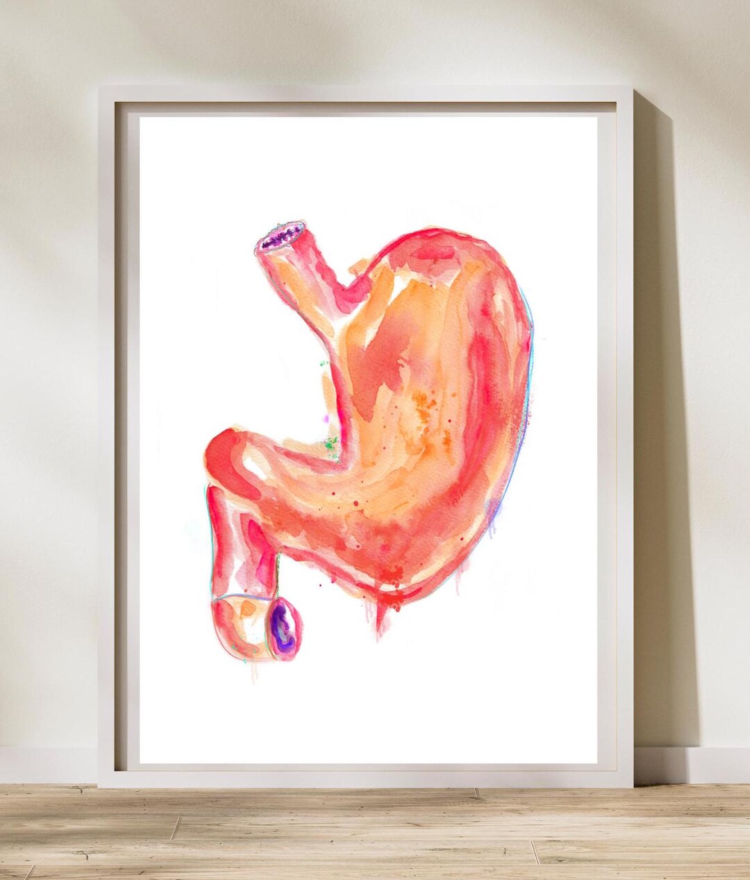 Stomach Gastrointestinal General Surgery Art, Endoscopy Wall Decor ...
